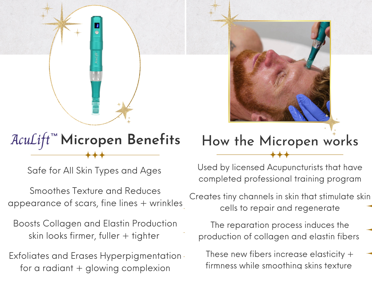 MicroNeedling - On Point Health Acupuncture